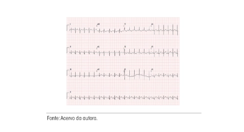 CLEXANE®: A escolha de antitrombótico com os atributos essenciais que ...